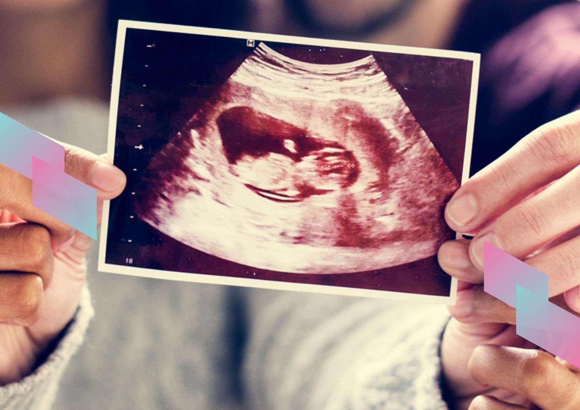 Understanding The Different Types of Baby Scan - Hey Baby 4D Stalybridge